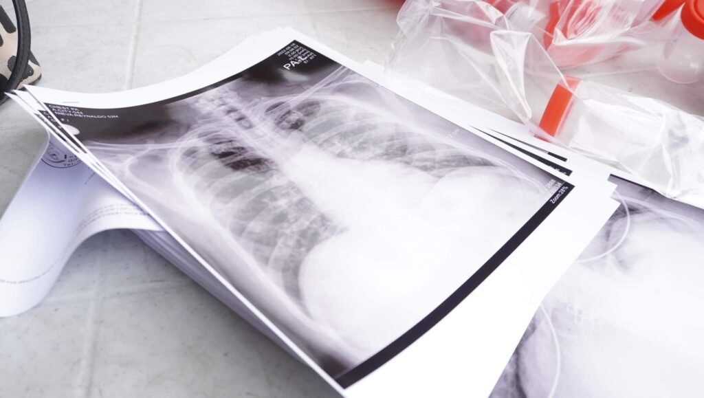 Angeles City Hall employees to undergo physical examination – The Voice ...